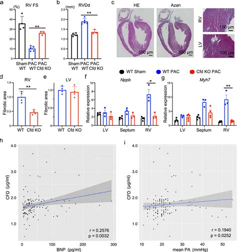 Complement Factor D Cfd Plays An Important Role In Mice With