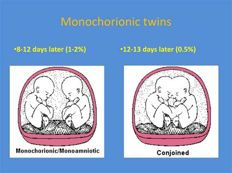 Ppt Multifetal Pregnancy Powerpoint Presentation Free Download Id