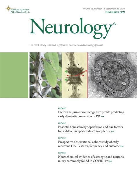 Herpes Zoster Lumbar Radiculitis Neurology