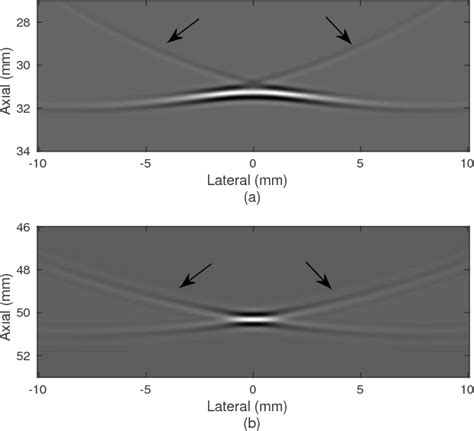 Figure 1 From A Method For Intrapulse Spatial Compounding Semantic