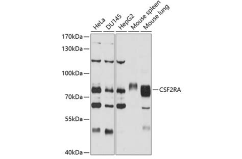 Anti Cd116 Antibody A11504