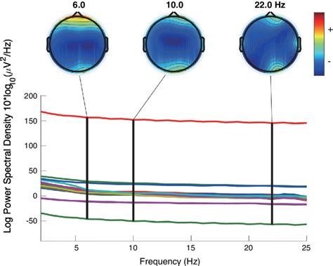 EEG Power Spectral Density Profiles For All Channels Download Scientific Diagram