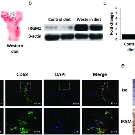 Pdf Irgm1 Regulates Oxidized Ldl Uptake By Macrophage Via Actin Dependent Receptor