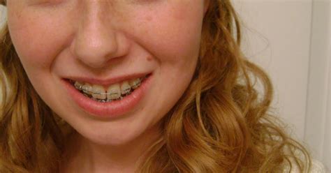The Conglomerated Chronicles Of Megan Tooth Bling