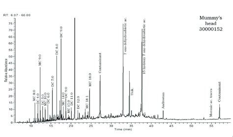 Gc Ms Chromatogram Of The Mummy 30000152 Download Scientific Diagram
