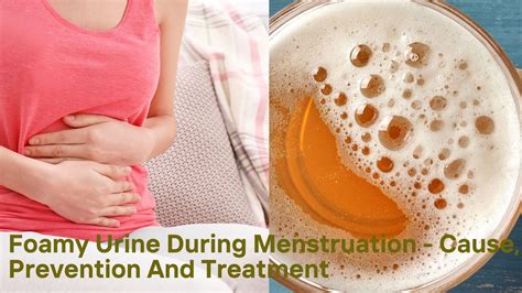 Foamy Urine During Menstruation Cause Prevention And Treatment