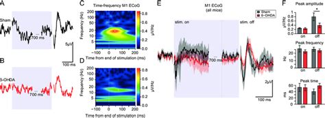 Electrocorticogram ECoG Response In The Primary Motor Cortex To Download Scientific Diagram