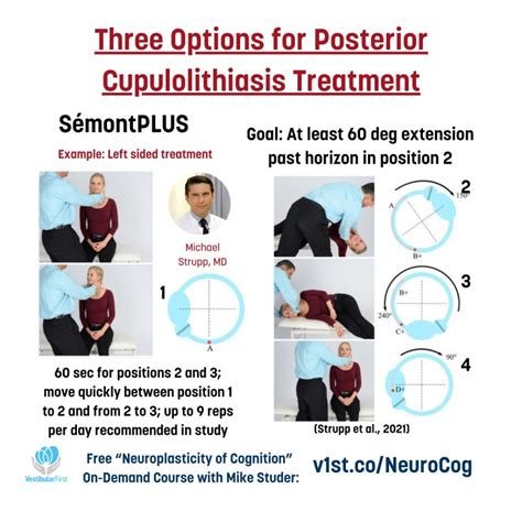 Bppv Vestibularrehabilitation Vestibular First