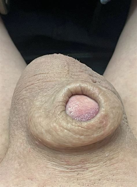 Tiny Micro Cock Pics Xhamster