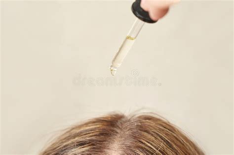 Hair Growth Serum Application On Caucasian Female Scalp For Hair Care