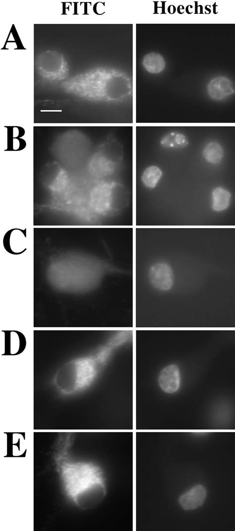 Cytochrome C Redistributes From The Mitochondria To The Cytoplasm