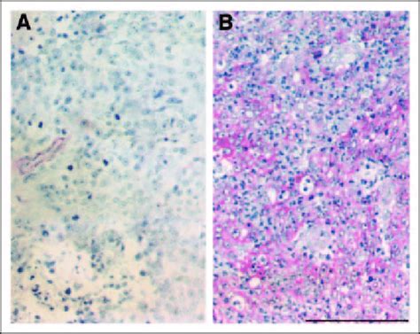 Immunohistochemical Detection Of Epidermal Growth Factor Receptor
