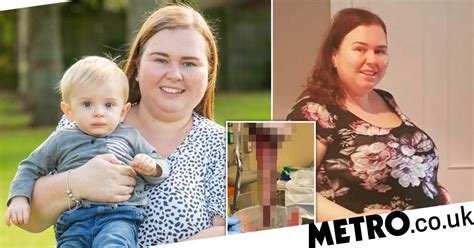 Mum Falls Pregnant While Using Coil And Finds It Lodged In Placenta