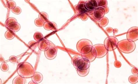 Se registró un caso de Candida Auris en Brasil Ciudadano News
