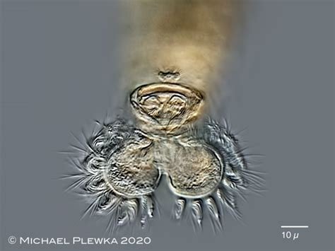 Bdelloid Rotifer Fauna Of Germany And Neighbouring Countries