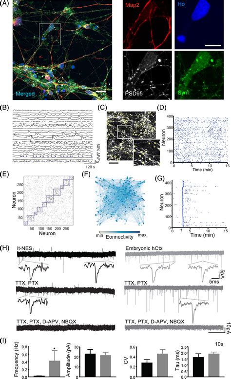 Grafted Human Pluripotent Stem Cell‐derived Cortical Neurons Integrate