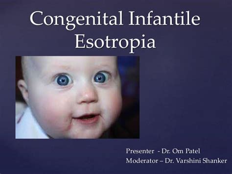 Congenital Infantile Esotropia