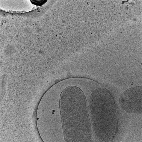 Cryoemproject2cellmembrane Instance Segmentation Model By Cryobacteria