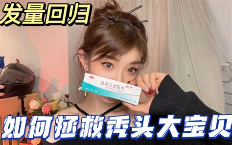 秃头大宝贝的生发密码和秃头说拜拜 哔哩哔哩