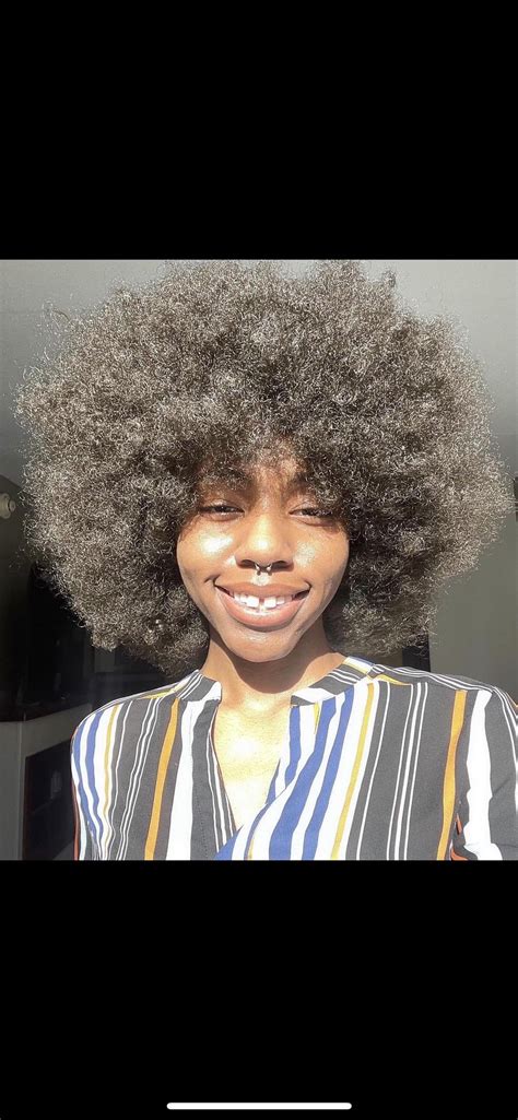 10 Month Update R Braces