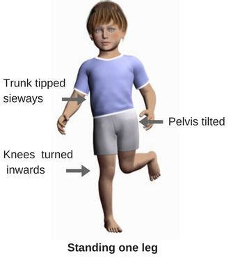 Pediatric Physical Therapy Pediatric Physical Therapy Activities