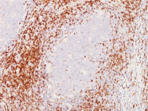Cd5 Mantle Cell Lymphoma Marker Monoclonal Antibody C5 473 Cd5 54