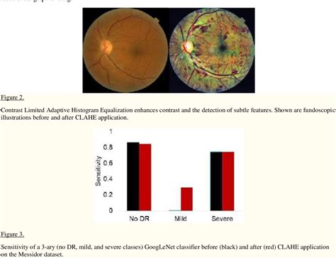 figure 3 from diabetic blindness detection system using convolution