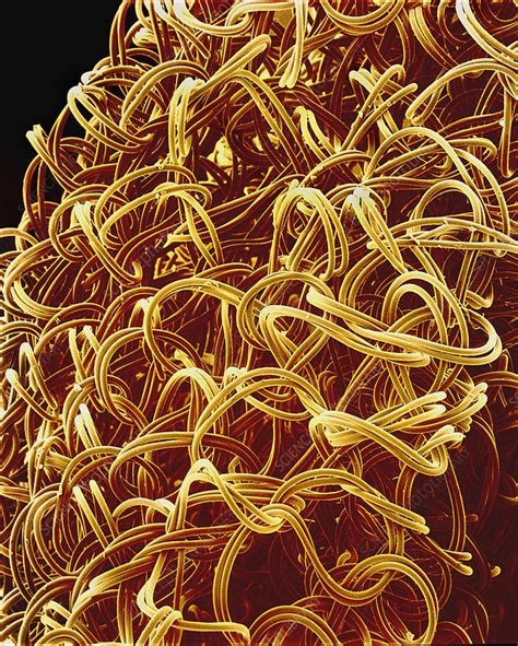 Nylon Stocking Sem Stock Image H120 0323 Science Photo Library