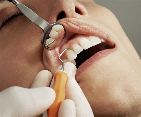 Gum Disease Treatments In Houston Tx All Stars Dental