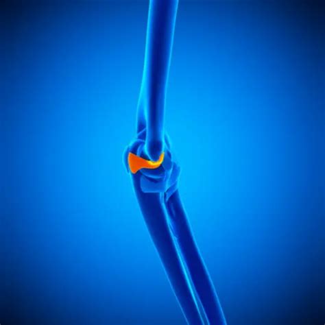Acl Pcl And Other Ligament Reconstruction Health And Wellness