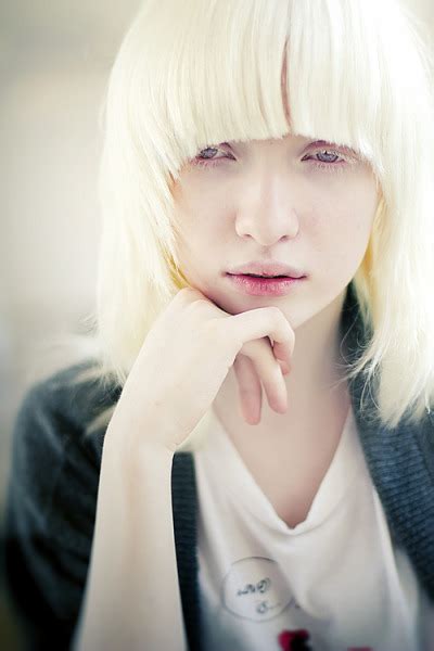 A Albina Mais Linda Do Mundo Explosion Lovers♥