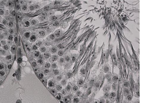 Solved Answer Asap Pls