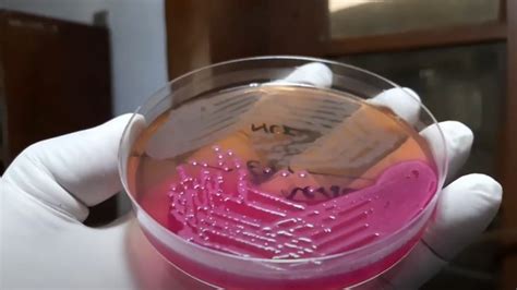 Micrococcus Luteus Yellow Color Colony On Nutrient Agar Archives