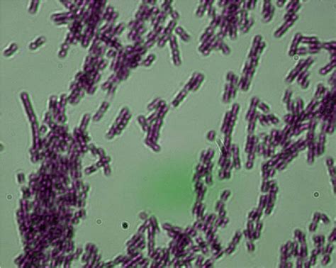 Figure 1 From Indirect Detection Of Bacillus Anthracis Anthrax Using Amplified Gamma Phage