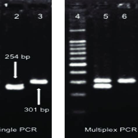 Pcr Amplification On Both Male And Female Samples Lane 1 And 4 100 Bp