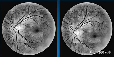 配准效果可视化 知乎