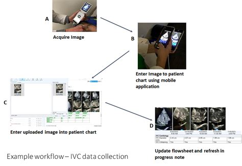 Video Author Spotlight Workflow For Integrating Pocus Data Into Ehr For Managing Heart Failure