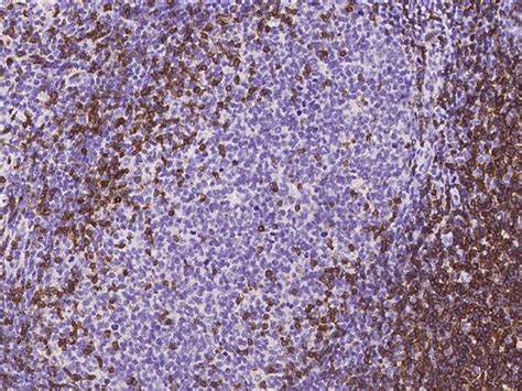 Sino Biological Cd3 Epsilon Cd3e Antibody Mouse Mab 50ul Quantity