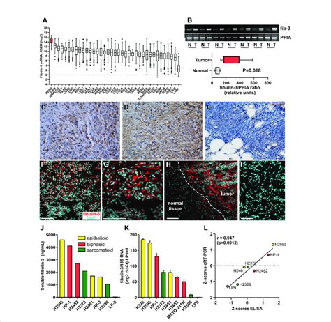 Fibulin 3 Is Upregulated In Mpm Cells And Tissues A Abundance Of