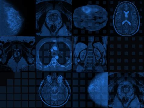 Pet Analysis Cancer Center Your Digital Center And Lis For Cancer