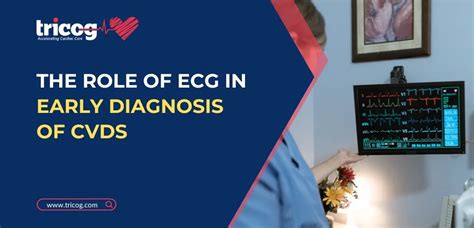 The Role Of Ecg In Early Diagnosis Of Cvds Tricog Health