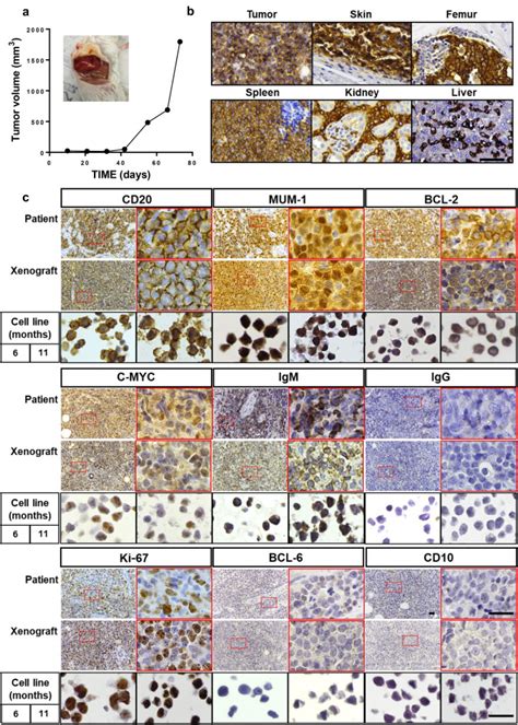 Patient Derived Xenograft And Cell Line Models Of Human Primary