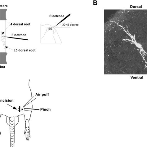Schematic Diagrams Of In Vivo Patch Clamp Recordings From The Download Scientific Diagram