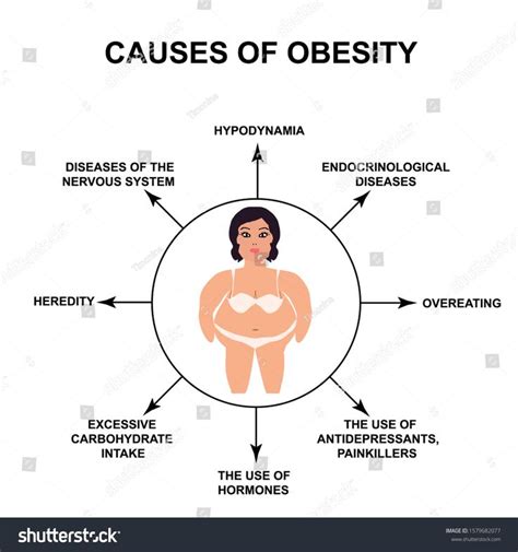 Causes Of Obesity International Day Against Obesity Infographics
