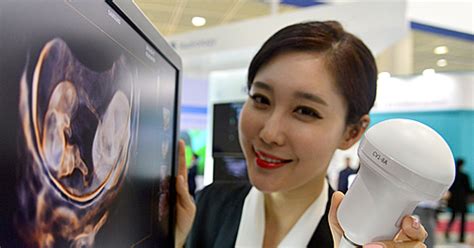 산부인과학회 임신부 초음파 급여 횟수 제한 재검토해야