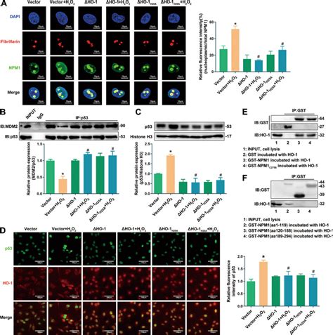 ho 1 nuclear accumulation and interaction with npm1 protect against