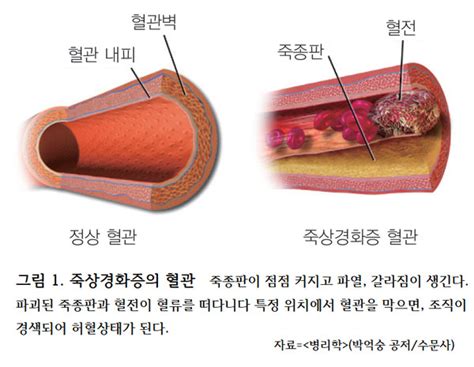 의사들은 왜 이렇게 혈압에 민감할까