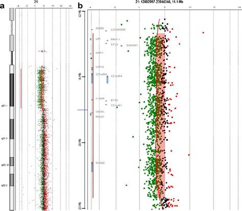 Array CGH Analysis Of The Patient S DNA A Chromosome View Showing Download Scientific