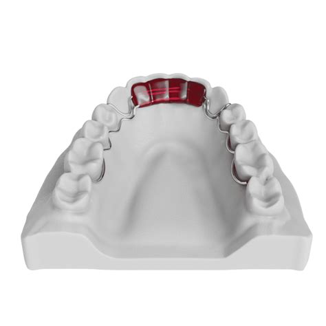 Super Spring Aligner Odl Orthodontic Labs