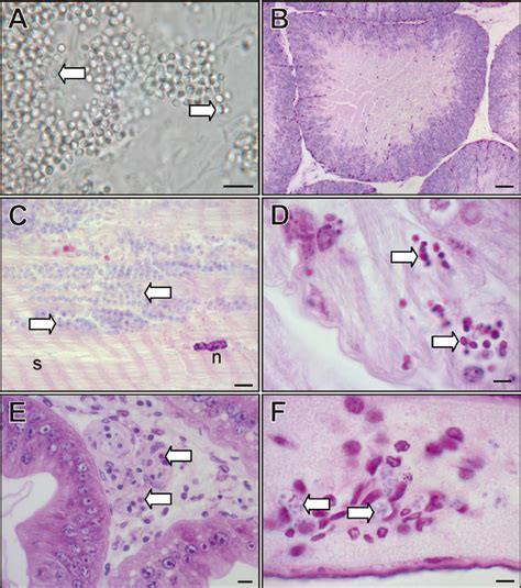 Light Microscopy Of Ameson Metacarcini Sp Nov Infecting Metacarcinus